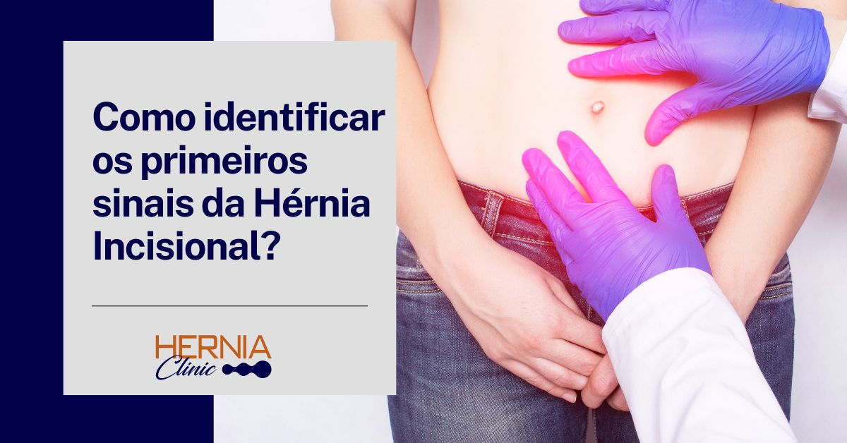 Cicatriz De Hernia Epigastrica Reparación De Hernia Umbilical En