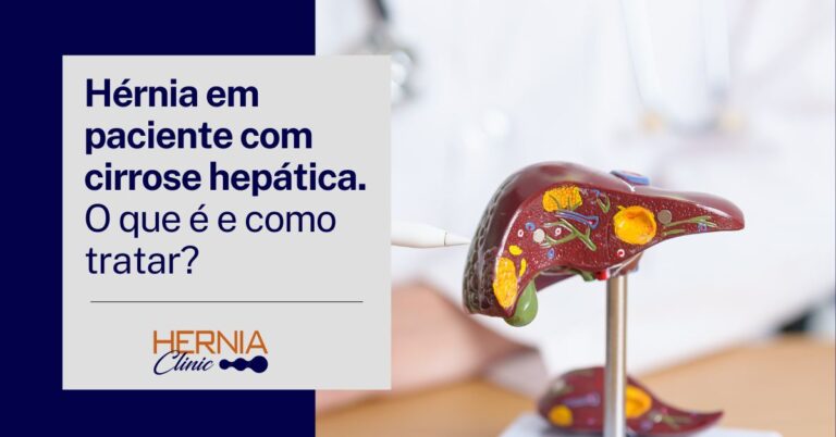Hérnia em paciente com cirrose hepática. O que é e como tratar ...
