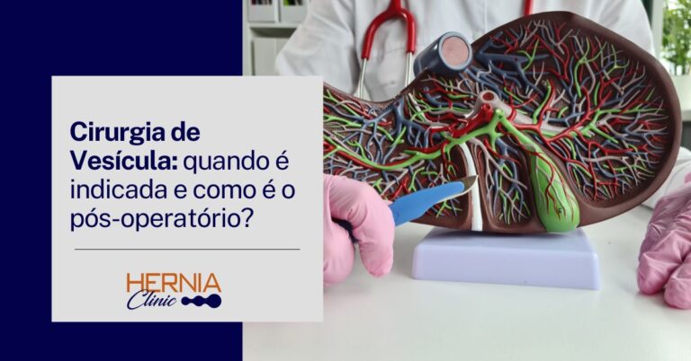 Cirurgia de Vesícula: quando é indicada e como é o pós-operatório ...