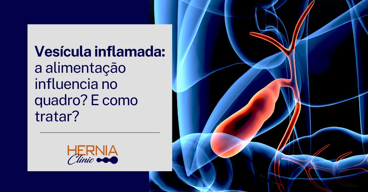 Vesícula inflamada: a alimentação influencia no quadro? E como tratar ...