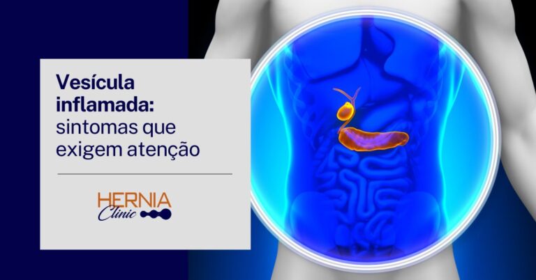 Vesícula inflamada: sintomas que exigem atenção - Centro de Hérnia em ...